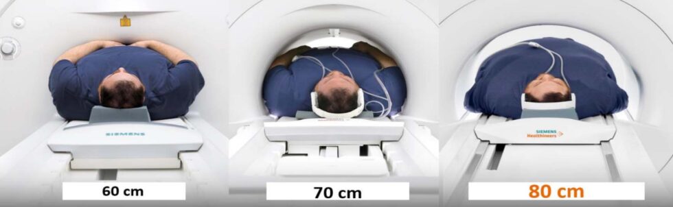 MRI | Spencer Imaging Center
